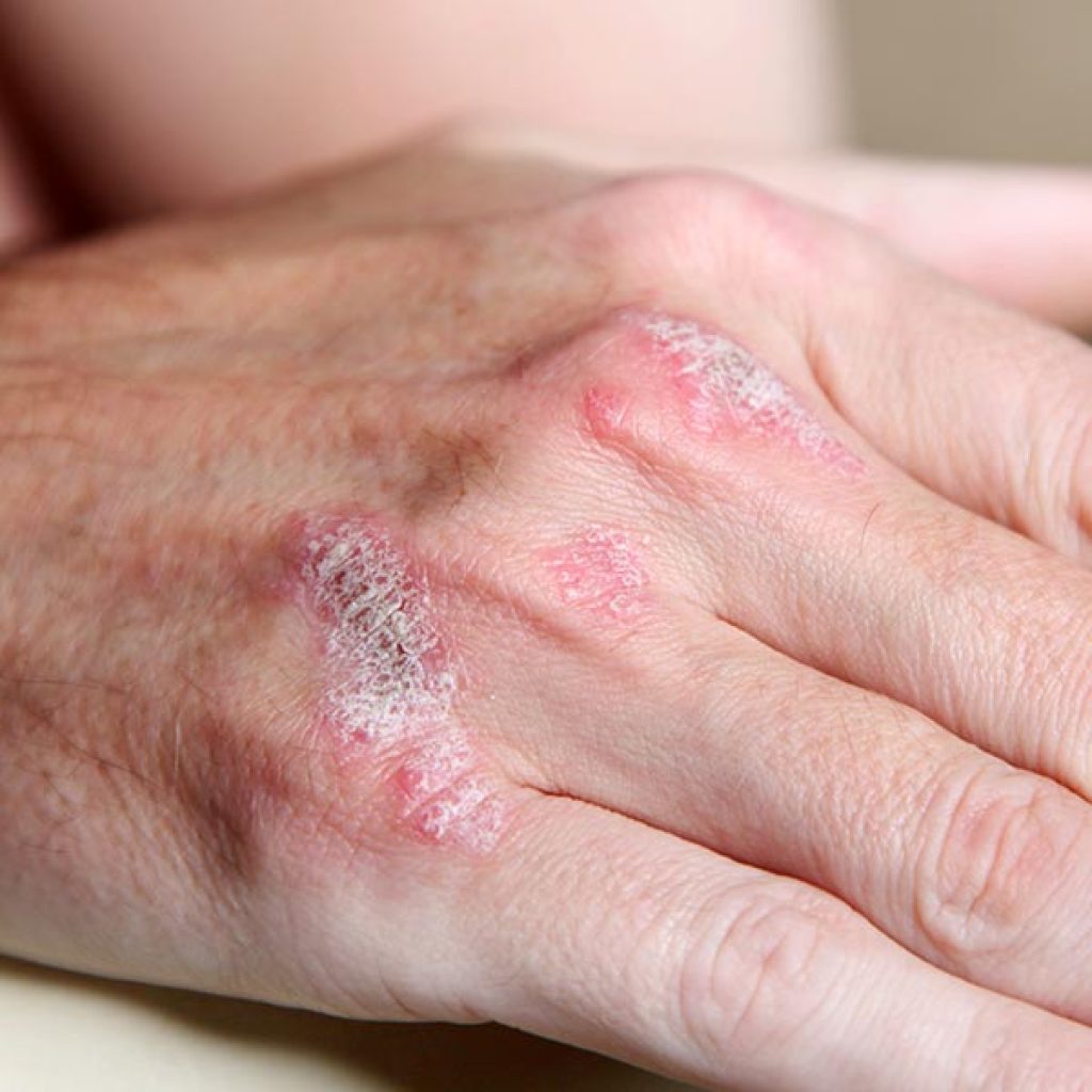 Advanced Rheumatology & Arthritis Wellness Center